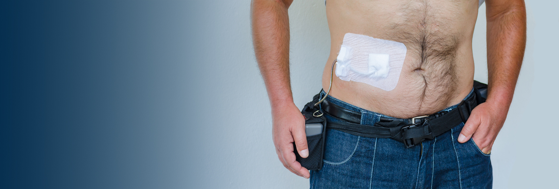 Ventricular Assist Device (VAD) | Cardiac Services | St Vincent's ...