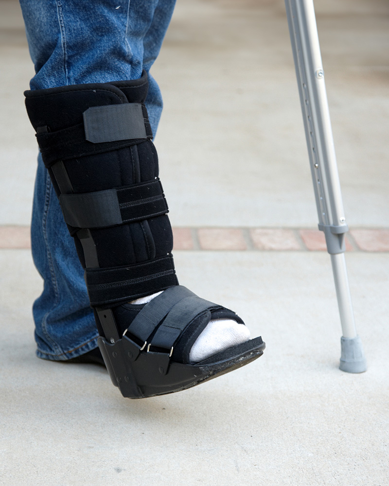 Ankle Ligament Surgery – Your Recovery