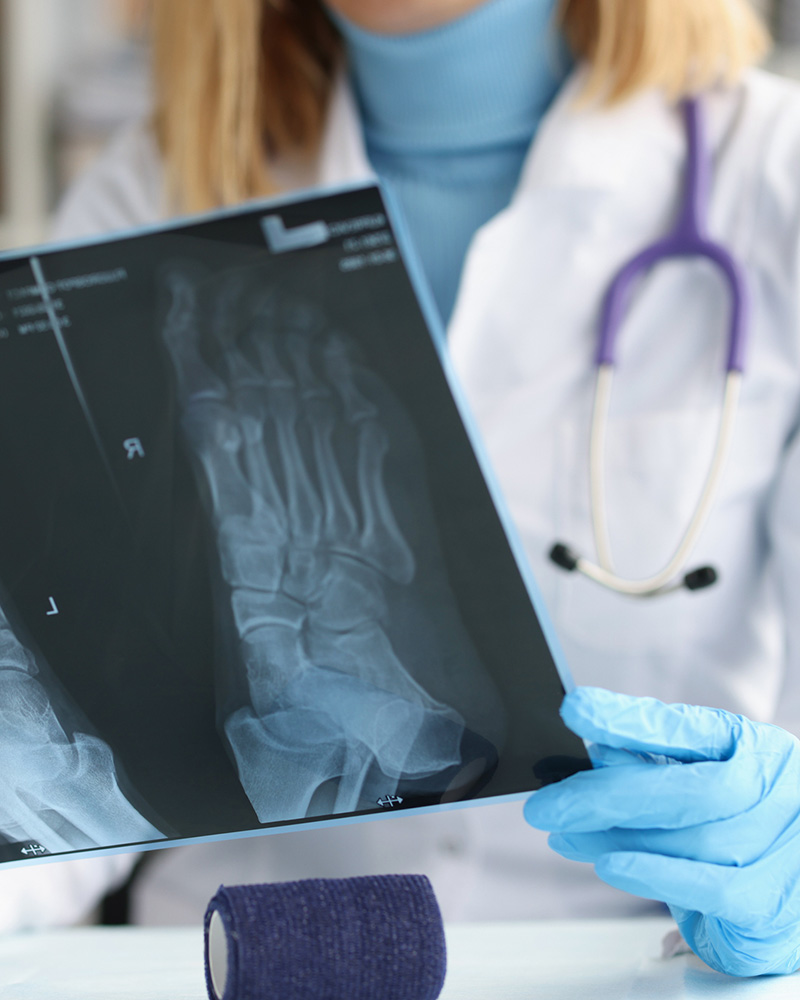 Foot Fracture I Orthopaedics I St Vincent’s Private Hospitals