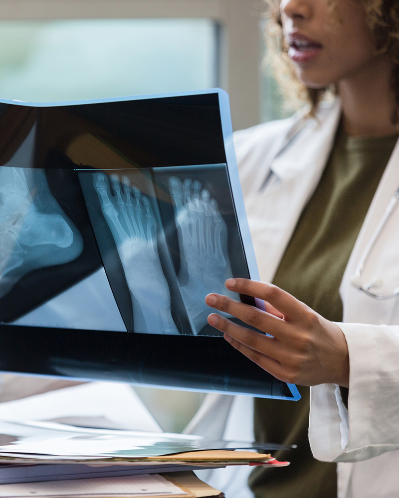 Plantar Fasciitis Surgery I Orthopaedics I St Vincent’s Private Hospitals