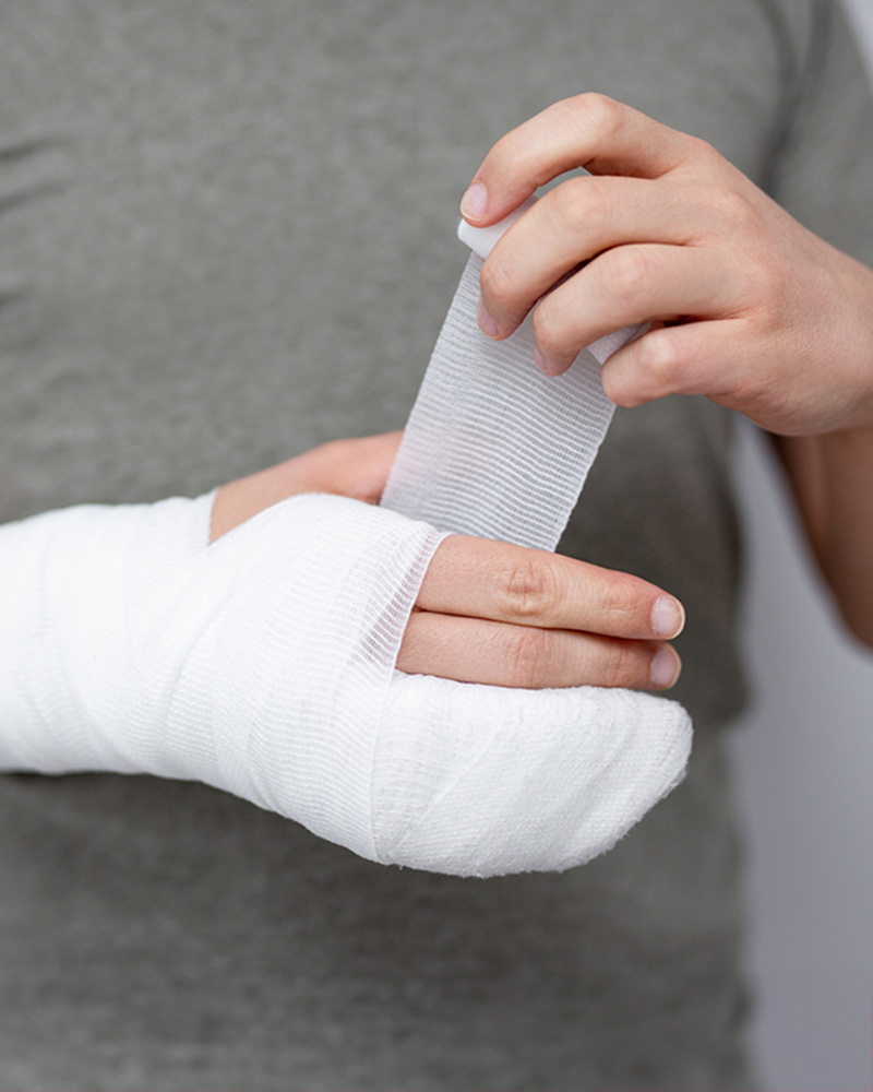 Dislocated Finger I Orthopaedics I St Vincent’s Private Hospitals