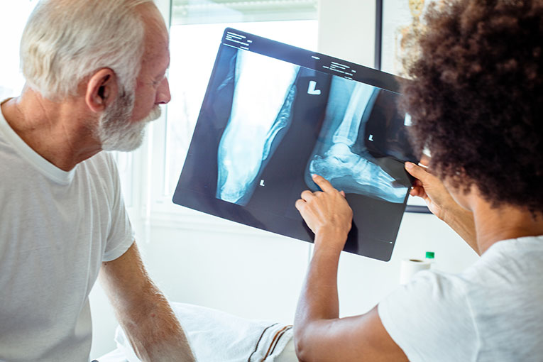 Ankle Replacement Surgery I Orthopaedics I St Vincent’s Private Hospitals