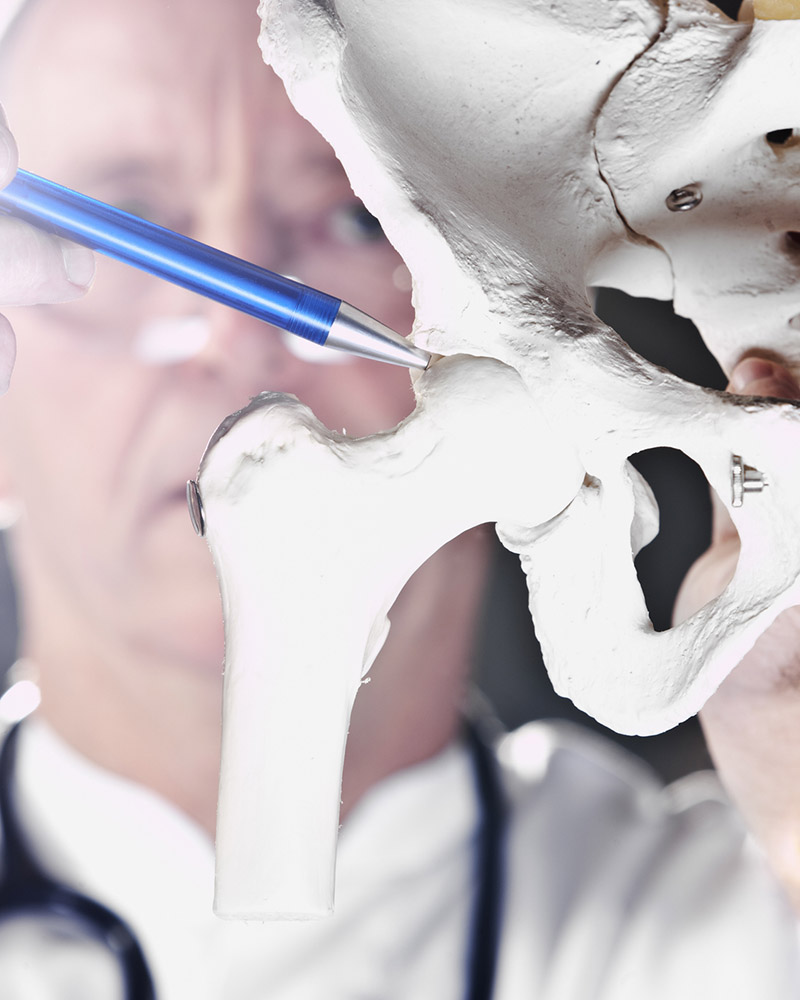 Hip Replacement Surgery in Brisbane I Orthopaedics I St Vincent’s ...