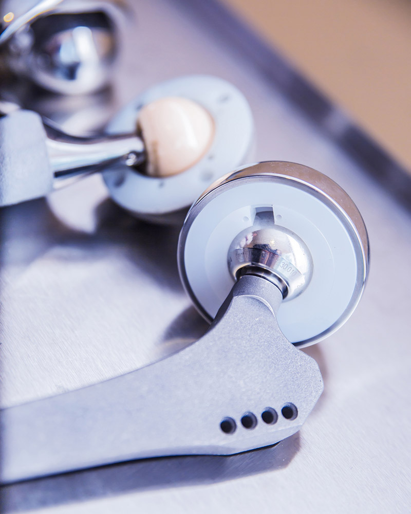 Hip Replacement Surgery in Toowoomba I Orthopaedics I St Vincent’s ...