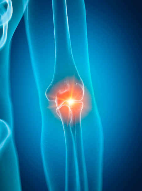 Sports Injuries: Hand, Wrist and Elbow